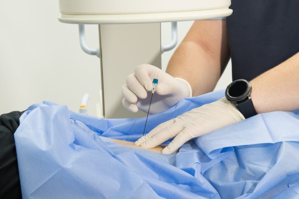 How Nerve Blocks Provide Drug-Free Back Pain Relief